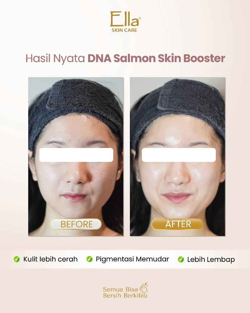 Ella Skin Care: The Power of DNA Salmon | Radio Elfara Malang